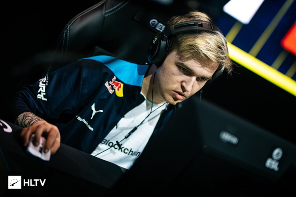 nafany在直播中表示手部遇到健康问题_5EPlay - 5EPlay赛凡网