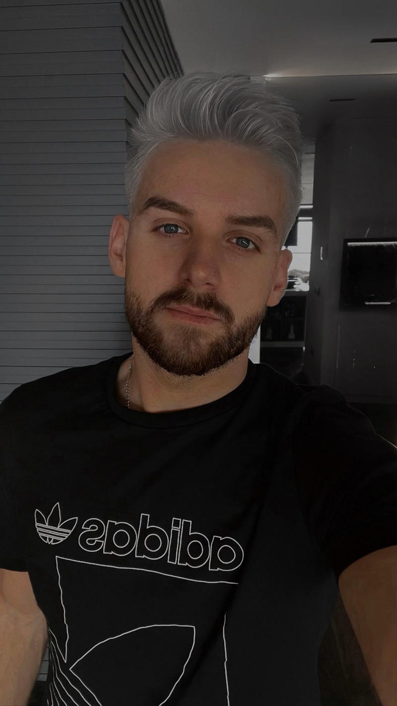 白毛限定NiKo：“CS不是压力游戏”_5EPlay - 5EPlay赛凡网