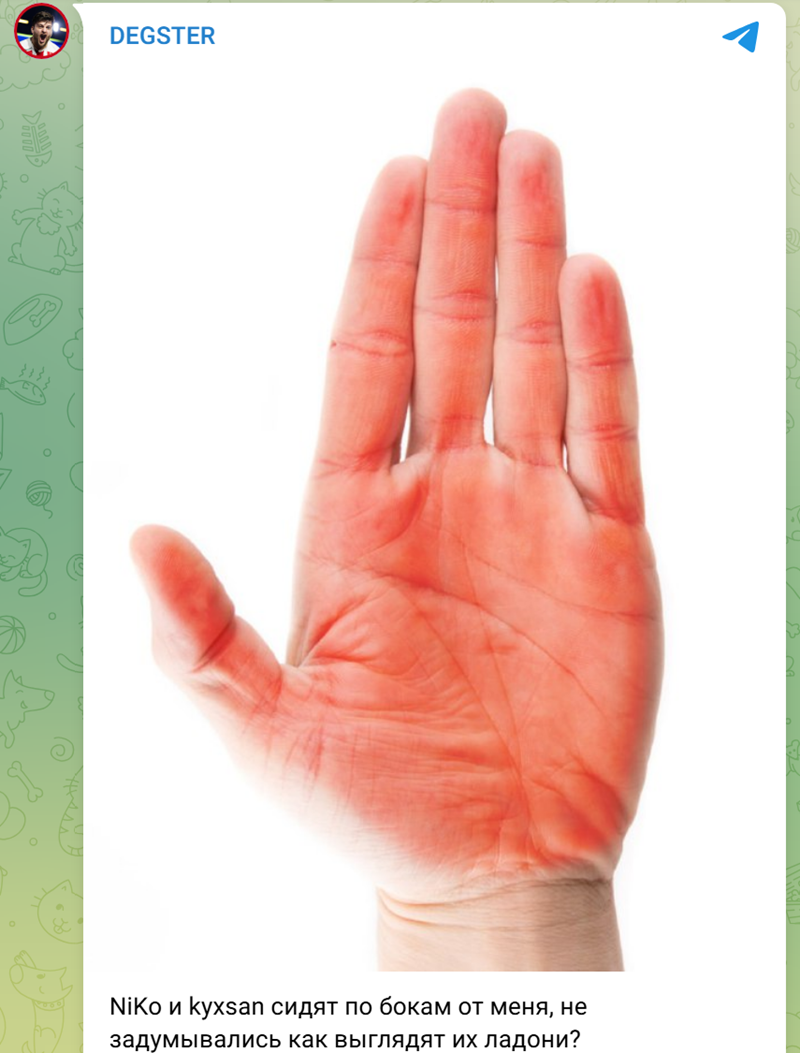 degster：有没有想过NiKo和kyxsan的手掌什么样？_5EPlay - 5EPlay赛凡网